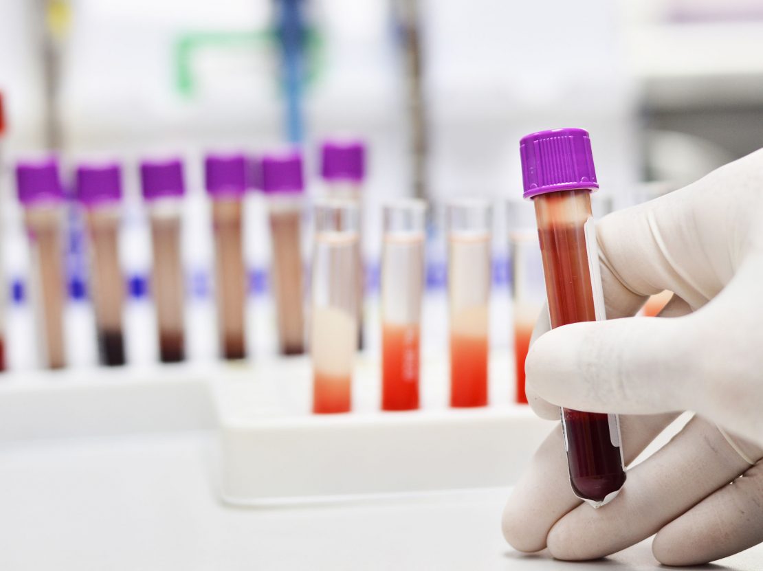 Platelet Rich Plasma Injection - Triangle Pain Consultants